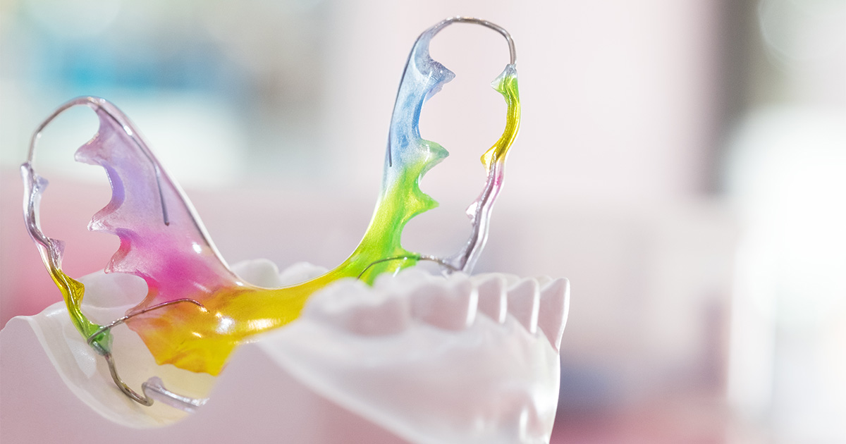 Der Retainer-Guide | Zahnarzt Köln - PAN Klinik in Köln